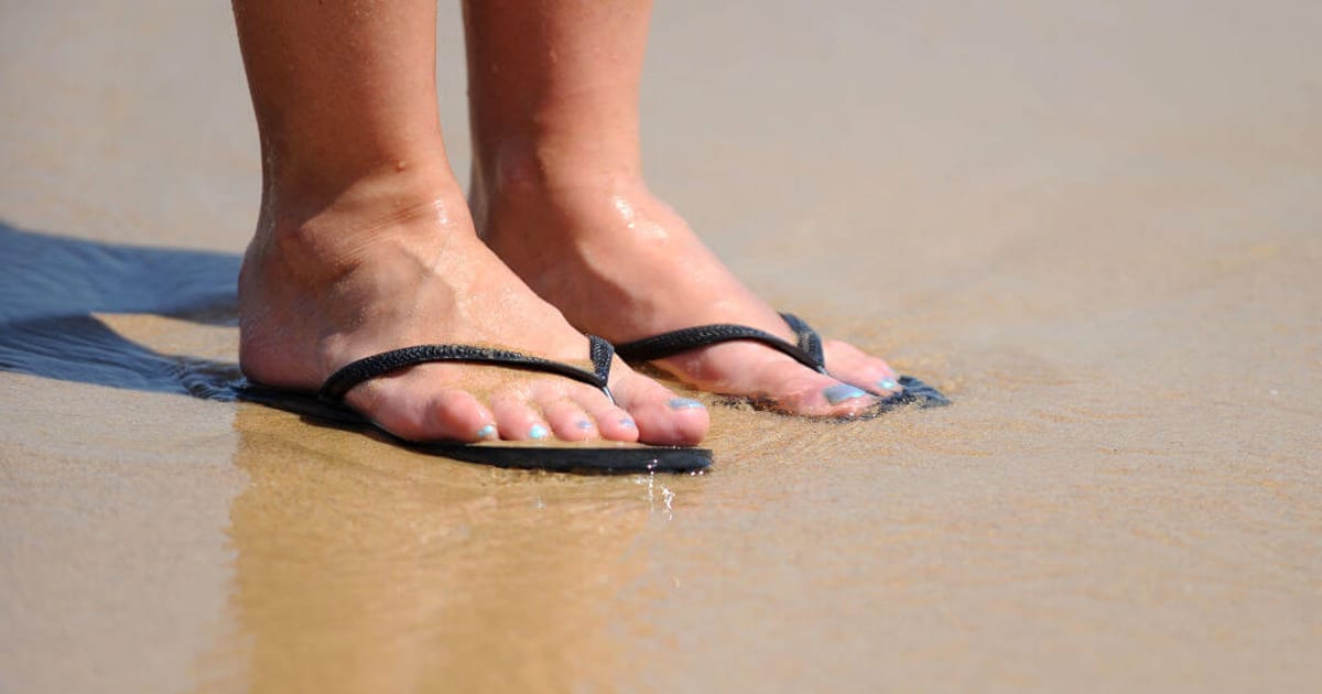 Flip-Flops – die gefährlichsten Latschen der Welt